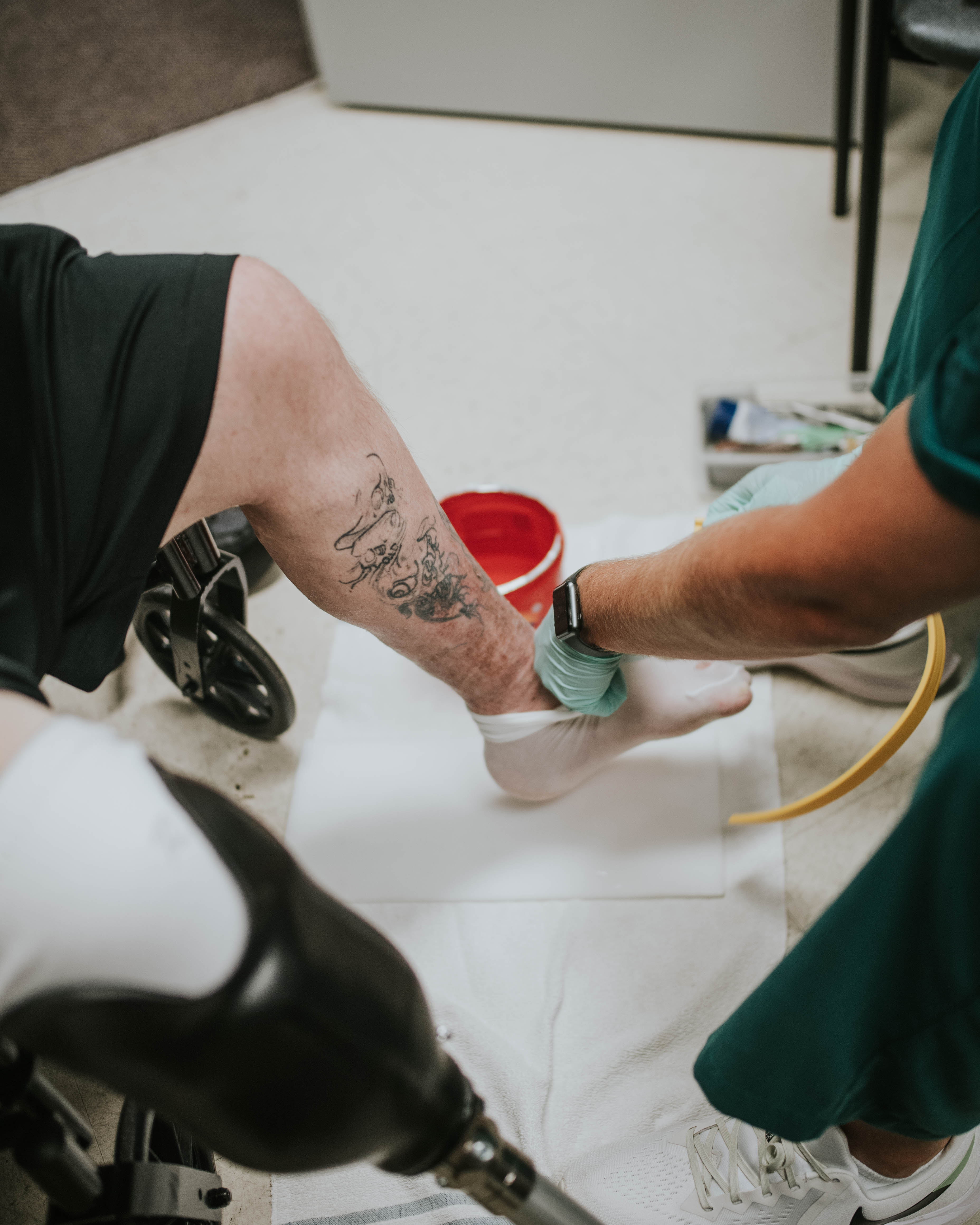 Prosthetic Services, Prosthetic Devices | Shreveport, LA | Certified ...