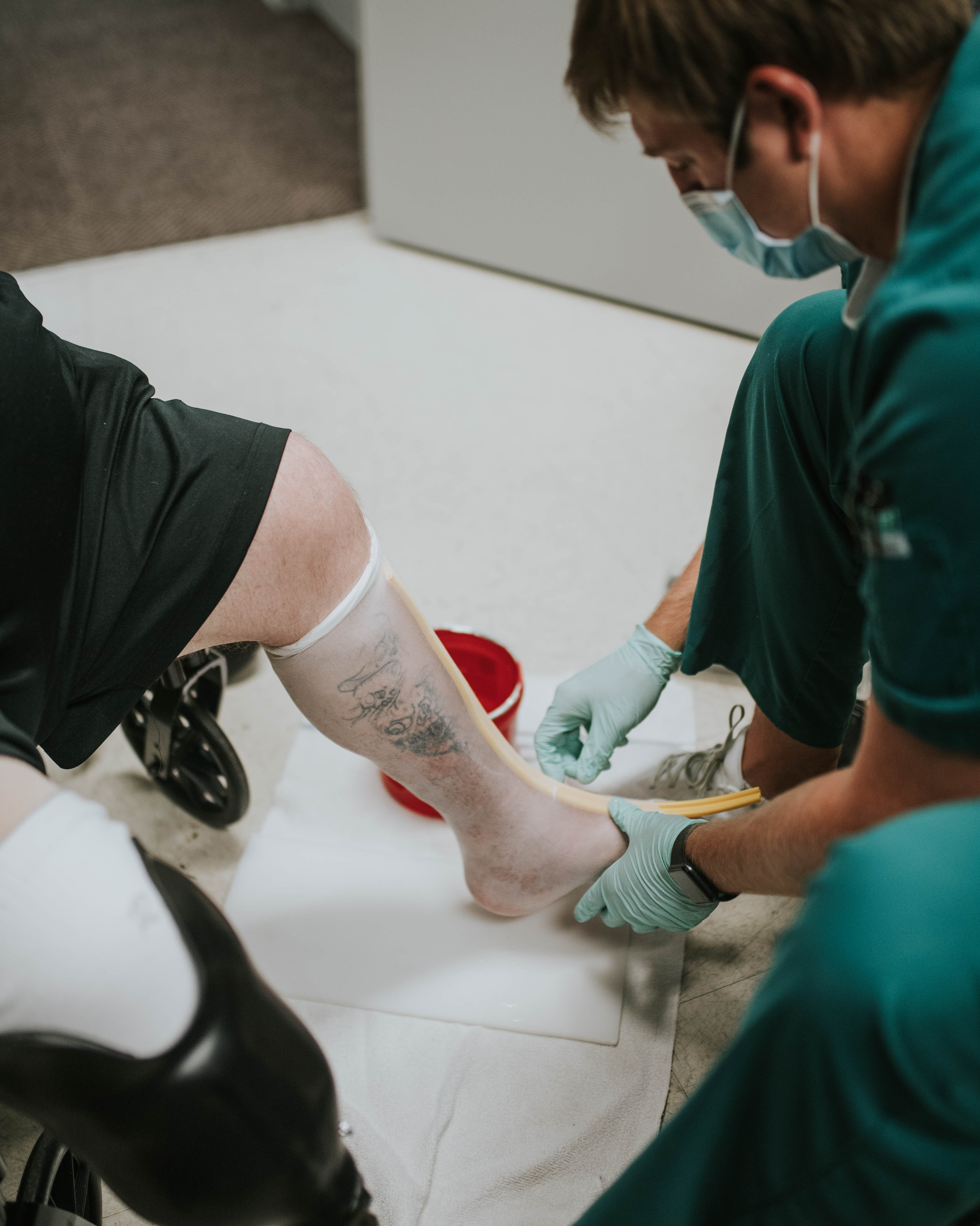 Prosthetic Services, Prosthetic Devices | Shreveport, LA | Certified ...