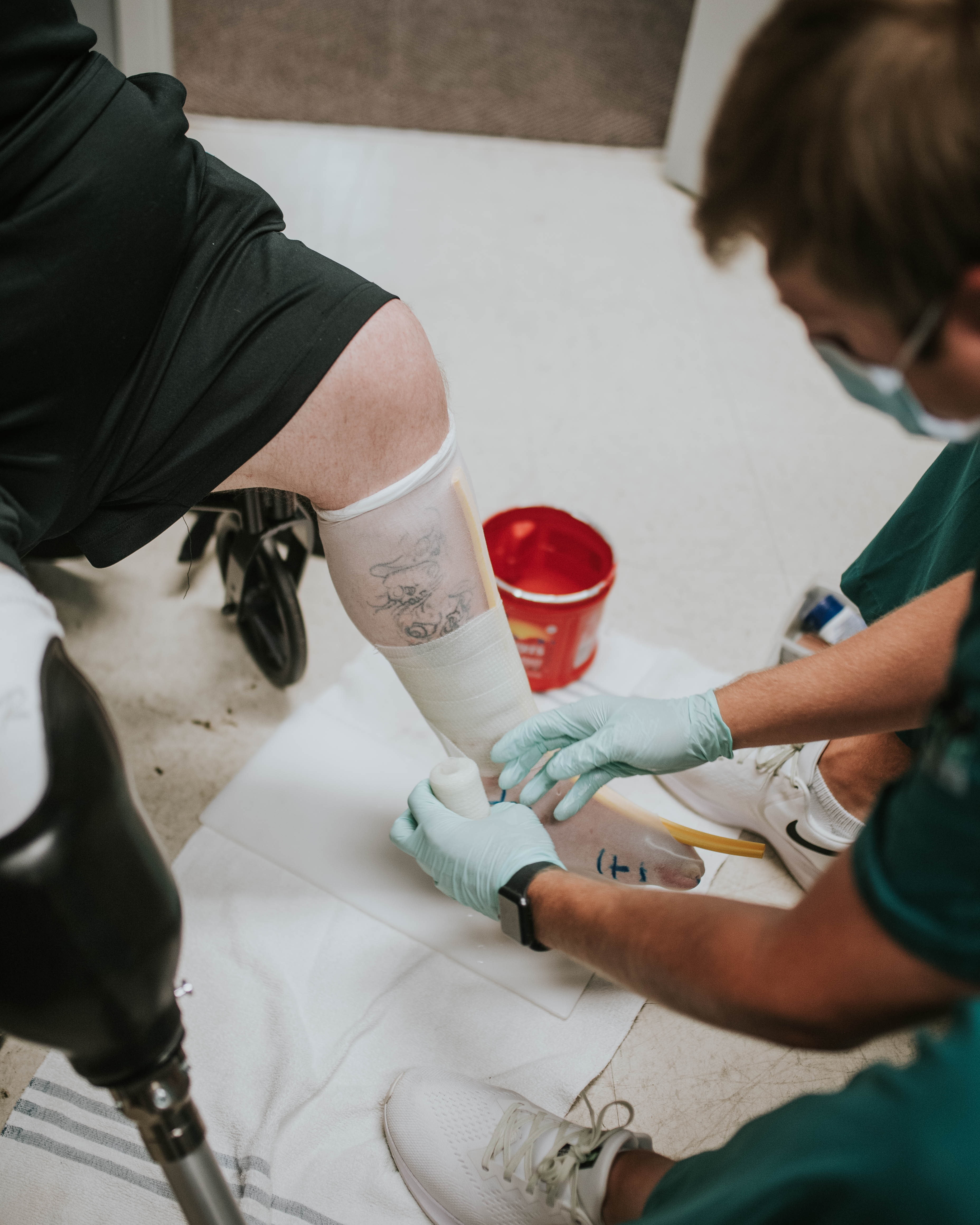 Prosthetic Services, Prosthetic Devices | Shreveport, LA | Certified ...